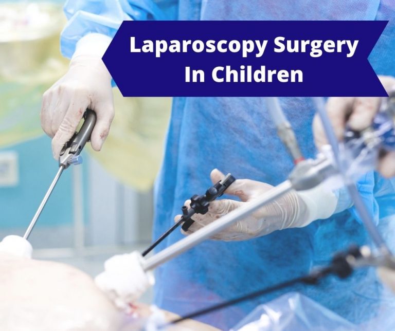 Laparoscopy Surgery in Children | Dr. Vishesh Dikshit